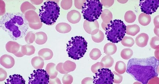 Los basófilos son las células del sistema inmune que inician la ...